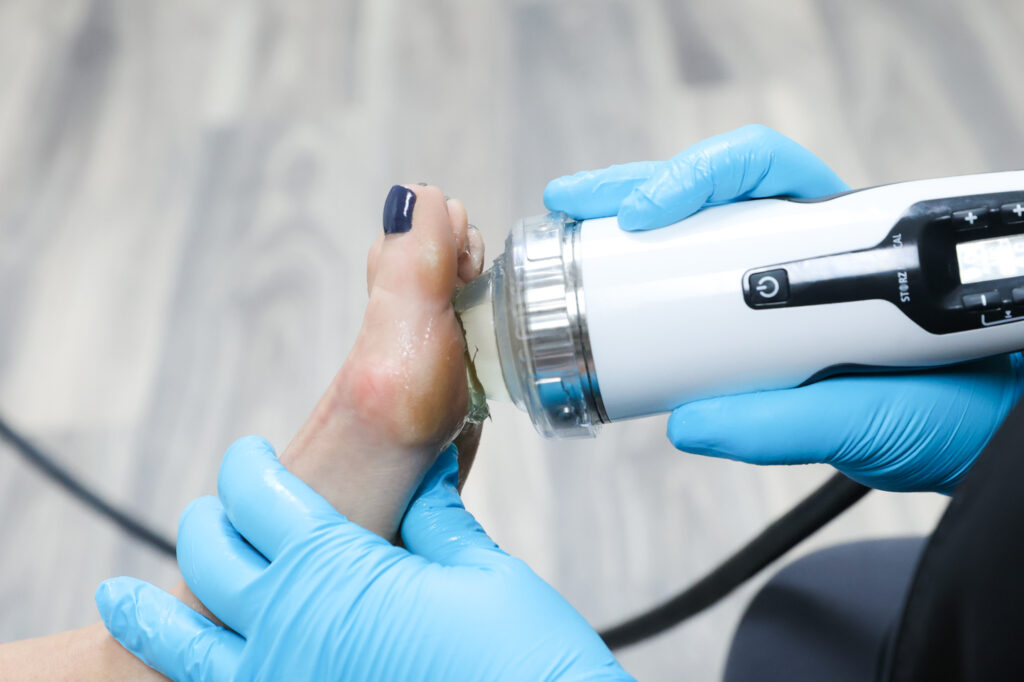 TotalWave Therapy in Mobile | Connexus Clinic